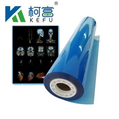 China Filme de raios-X Médicos de Fábrica Azul Filme de raios-X Médicos Sensíveis à venda