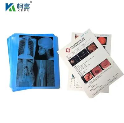 China CT Scanner Seco Raio-X 24x30 Inch Film Inkjet Verde Azul Base Médica Raio-X Film à venda