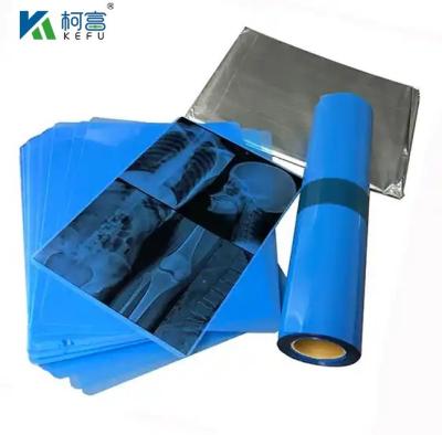 China Imagens médicas de filme térmico/jet de tinta baseado em raios X PET azul para clínicas e hospitais à venda