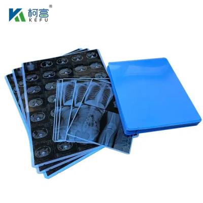 China Dicom Software Impressão Jato de tinta Raio X Filme médico azul para Ct Cr Mr Imagem à venda