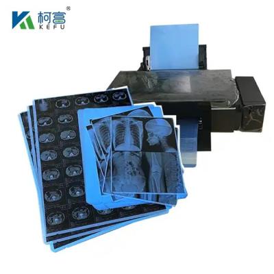 China Filme Médico de Jato de Tinta / Laser de Tamanho Múltiplo Branco e Azul Transparente à venda