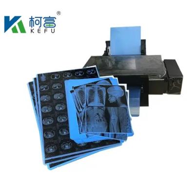 China Folhas de tamanho personalizado A3 Rolls Blue Inkjet Medical Film Para Impressão de Imagem Médica CT, CR, DR, MTR à venda