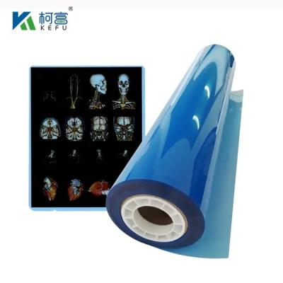 China Impressora de jato de tinta de saída de imagem de raio X de filme seco médico azul para máquina médica à venda
