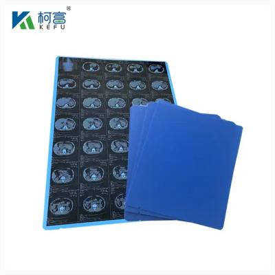 China Radiology PET Dry Inkjet Blue Medical Film 8x10 10x12 11x14 14x17 Inch Medical Orthopedic X Ray Films for sale