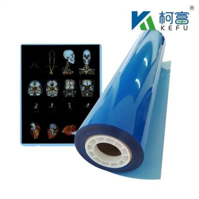 China Blue Medical X-ray Dry Film Hospital CT Imagem Médica Inkjet impermeável à venda