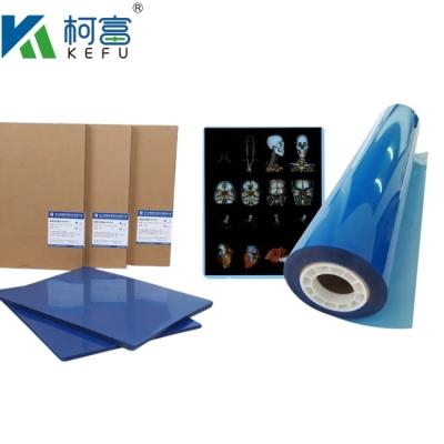 China Dimensão personalizada 35x43 Inkjet Filme de raios X Médico Azul Para Epson A4 PET Laser Médico Azul Seco à venda