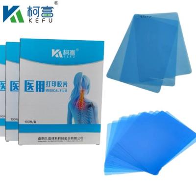 China Tamanho personalizado Tinta de jato de azul de raio-X médico filme para Epson A4 A3 PET Seco azul médico laser de raio-X em venda à venda