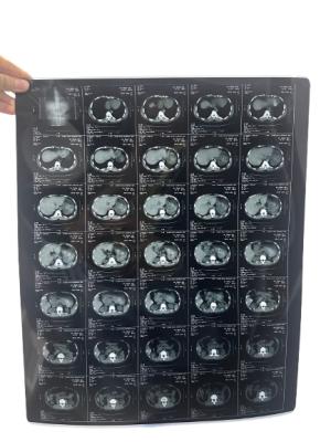 Cina Min Densità 0,28D Film a raggi X per risultati diagnostici accurati e dettagliati in vendita