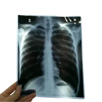 Cina Ultimo Disegno Personalizzato 8*10 Pollici Film Medicale a Raggi X Asciutto Per Stampanti A3 A4 in vendita