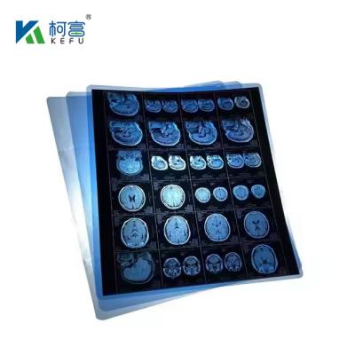 Cina Film medico a getto d'inchiostro trasparente bianco blu / laser Film a raggi X in vendita