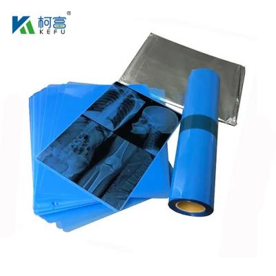 China 175mic 215mic High Definition Medical Imaging CT DR Inkjet Blue Film Medical X-ray Pet Film A3 A4 Transparent Blue Printing Film for sale