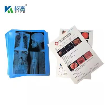 China Medical Laser Film With High Color Accuracy And Fidelity 14x18in 0.16mm For True - To - Life Diagnostic Images for sale