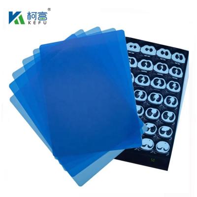 Cina Immagine medica CT ospedaliera Inkjet impermeabile Blu Medicale X-ray Film asciutto in vendita