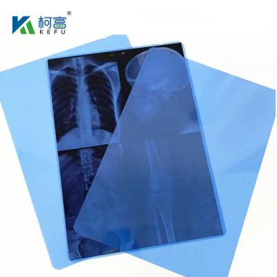 Cina 10*12in Film di scansione a secco per raggi X/CT/DR per stampante laser a raggi X e apparecchiature per stampante di immagini termiche in vendita