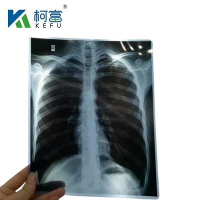 Cina 8x10 pollici 14x17 pollici Blu Film Medicale a raggi X Substituto Fuji Medicale Film asciutto Per Clinica E Ospedali in vendita