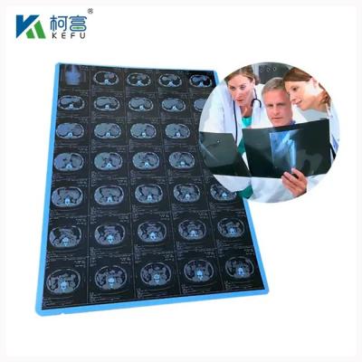 China Scratch - Resistant And Durable Medical Laser Film 6x8in 0.10mm Ensuring Long Term Use In Busy Medical Environments for sale