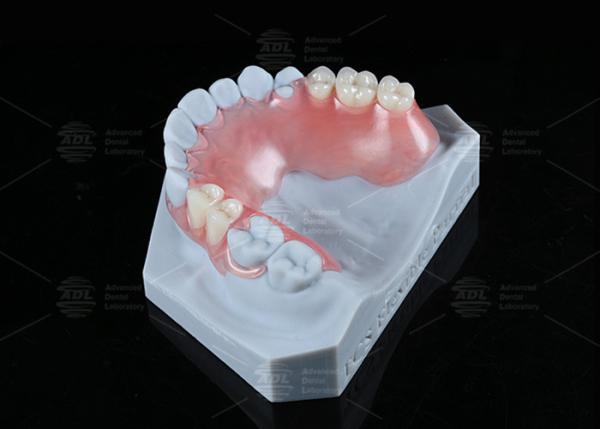 Quality TCS Flexible Partial Stain Resistant BPA Free Partial Dentures For Natural Look for sale