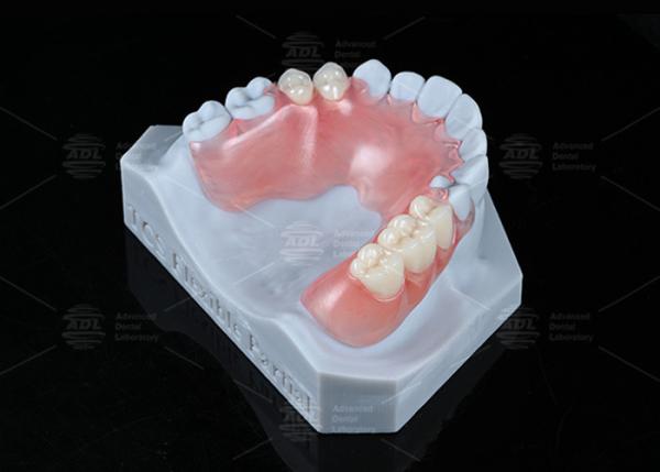 Quality TCS Flexible Partial Stain Resistant BPA Free Partial Dentures For Natural Look for sale