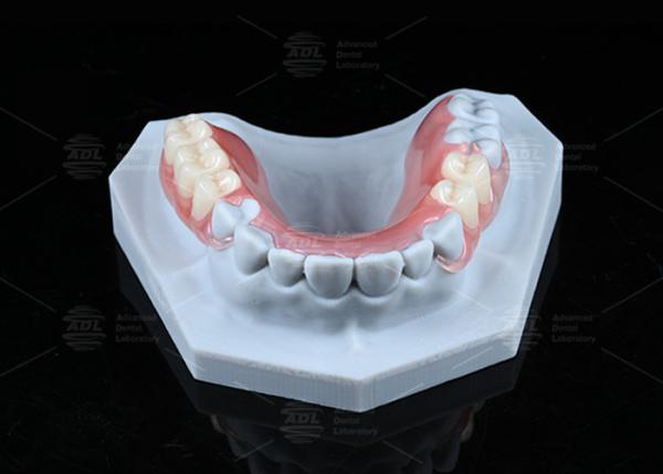 Quality TCS Flexible Partial Stain Resistant BPA Free Partial Dentures For Natural Look for sale