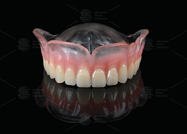 Quality Vertex Clear And Pink Full Denture Virtually Unbreakable Affordable Partial for sale