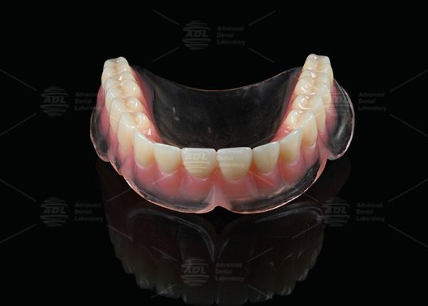 Quality Vertex Clear And Pink Full Denture Virtually Unbreakable Affordable Partial for sale