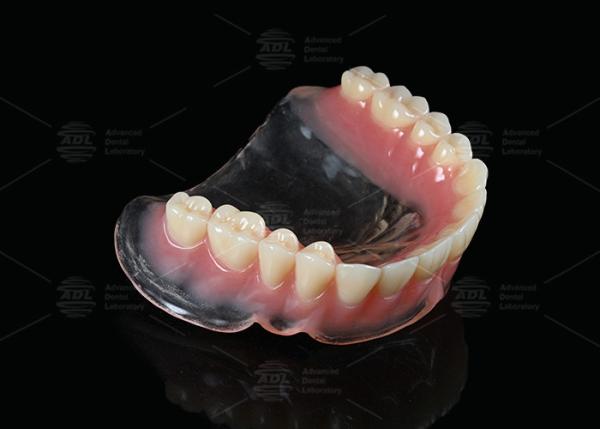 Quality Vertex Clear And Pink Full Denture Virtually Unbreakable Affordable Partial for sale