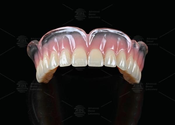 Quality Vertex Clear And Pink Full Denture Virtually Unbreakable Affordable Partial for sale