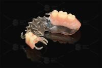 Quality Vertex Clear Flexible Partial Virtually Unbreakable Low Allergy Risk Full manufacturer