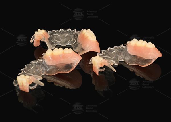 Quality Vertex Clear Flexible Partial Virtually Unbreakable Low Allergy Risk Full for sale