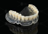 Quality Heat Curing Vertex Thermosens Dentures For Clear Full Denture Wearers manufacturer
