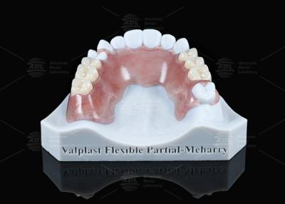 Lightweight Valplast Flexible Partial With Excellent Retention In Pink And Meharry