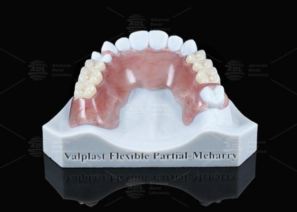 China Lightweight Valplast Flexible Partial With Excellent Retention In Pink And Meharry supplier