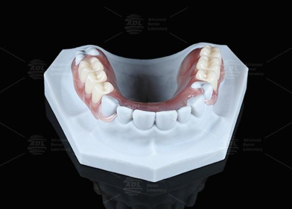 Quality Lightweight Valplast Flexible Partial With Excellent Retention In Pink And for sale