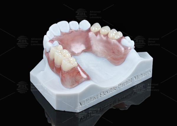 Quality Lightweight Valplast Flexible Partial With Excellent Retention In Pink And for sale