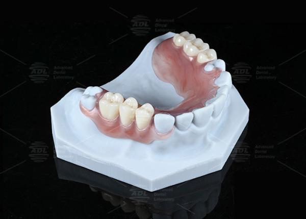 Quality Lightweight Valplast Flexible Partial With Excellent Retention In Pink And for sale