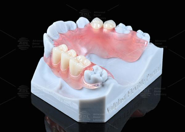 Quality Natural Looking Valplast Partial Denture Longevity Highly Resistant To Fractures for sale