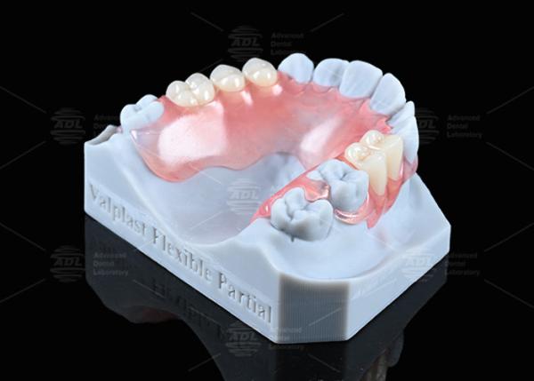Quality Natural Looking Valplast Partial Denture Longevity Highly Resistant To Fractures for sale