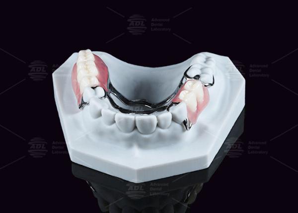 Quality Removable Metal Acrylic Partial Denture With Clasps For Partial Chewing for sale