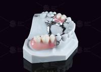 China Removable Metal Acrylic Partial Denture With Clasps For Partial Chewing for sale