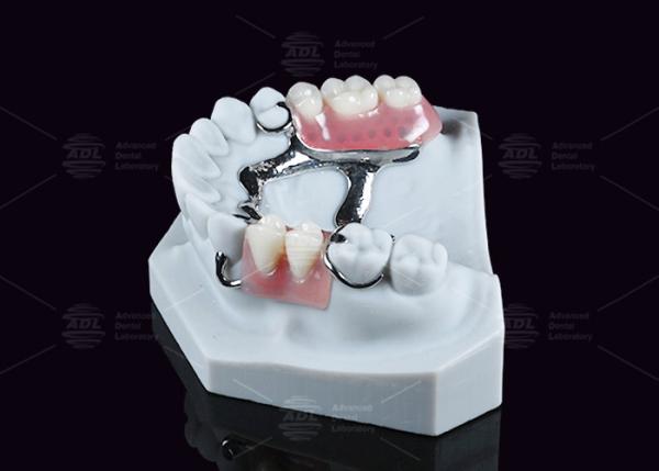 Quality Removable Metal Acrylic Partial Denture With Clasps For Partial Chewing for sale