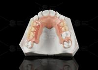 Quality White And Pink Peek Flexible Acrylic Partial Denture With Excellent Resistance manufacturer