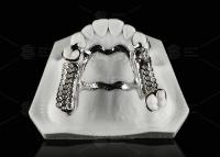 Quality Repairable Cobalt Chromium Dental Metal Framework Partial Denture manufacturer