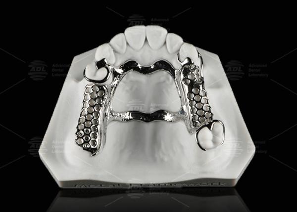 Quality Repairable Cobalt Chromium Dental Metal Framework Partial Denture for sale