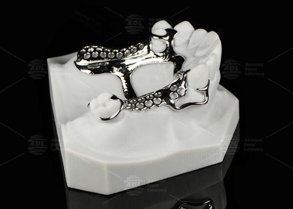 Quality Repairable Cobalt Chromium Dental Metal Framework Partial Denture for sale
