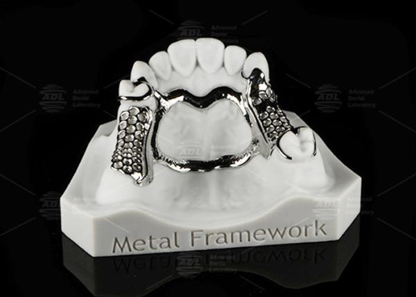 Quality Repairable Cobalt Chromium Dental Metal Framework Partial Denture for sale