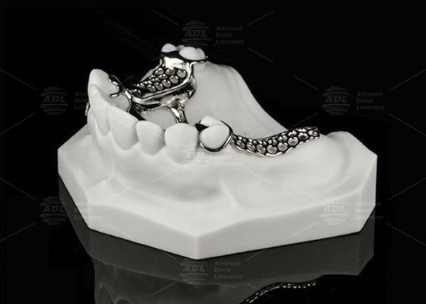 Quality Repairable Cobalt Chromium Dental Metal Framework Partial Denture for sale