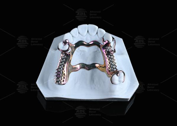 Quality Sensitive Skin High Strength Titanium Framework Solution 3D Printed for sale