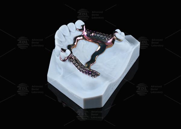 Quality Sensitive Skin High Strength Titanium Framework Solution 3D Printed for sale