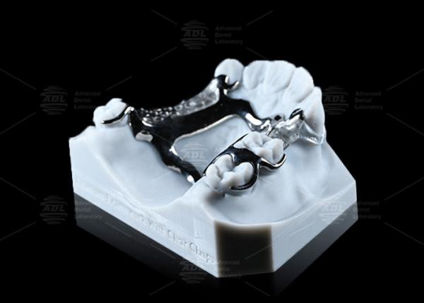 Quality High Strength 3D Printed Titanium Framework With Clear Clasps For Durable for sale