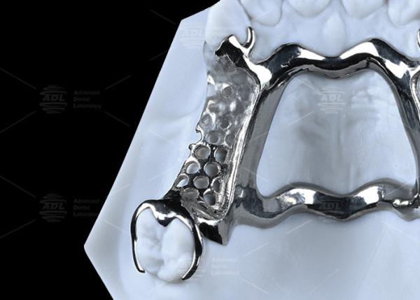 Quality High Strength 3D Printed Titanium Framework With Clear Clasps For Durable for sale